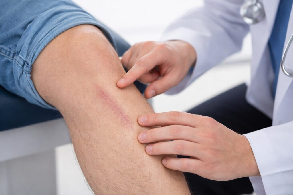 Scar Tissue Therapy in Honolulu: Heal and Move Better - NORTHEAST ...